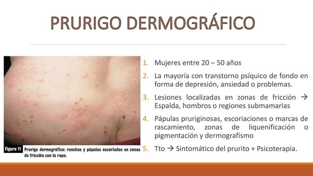 Prurigo agudo, subagudo y crónico | PPTX