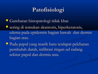 Prurigo hebra | PPT