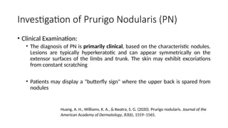 Prurigo Nodularis the basic knowledge for non dermatologist | PPTX