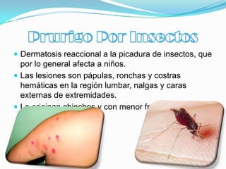 Prurigo Por Insectos Ppt