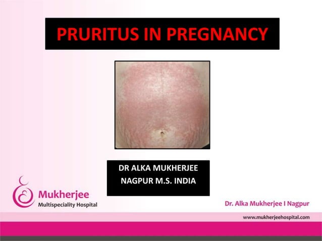 Pruritis in pregnancy by dr alka mukherjee dr apurva mukherjee nagpur m ...