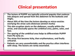 Pruritis in pregnancy by dr alka mukherjee dr apurva mukherjee nagpur m ...