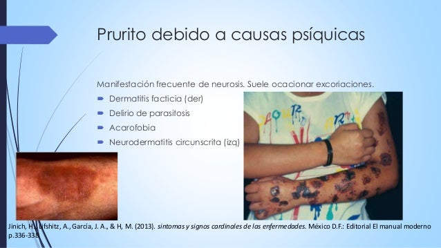 Prurito