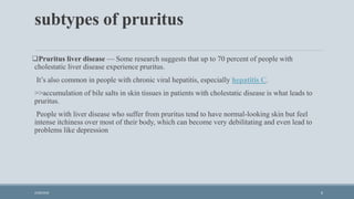 Pruritus | PPTX