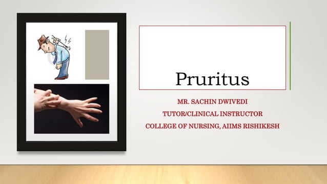Pruritus and its management by Sachin Dwivedi.pptx | Skin and ...