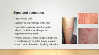 Pruritus and its management by Sachin Dwivedi.pptx
