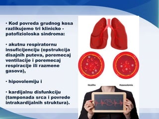 Prva pomoc kod povreda grudnog kosa | PPTX