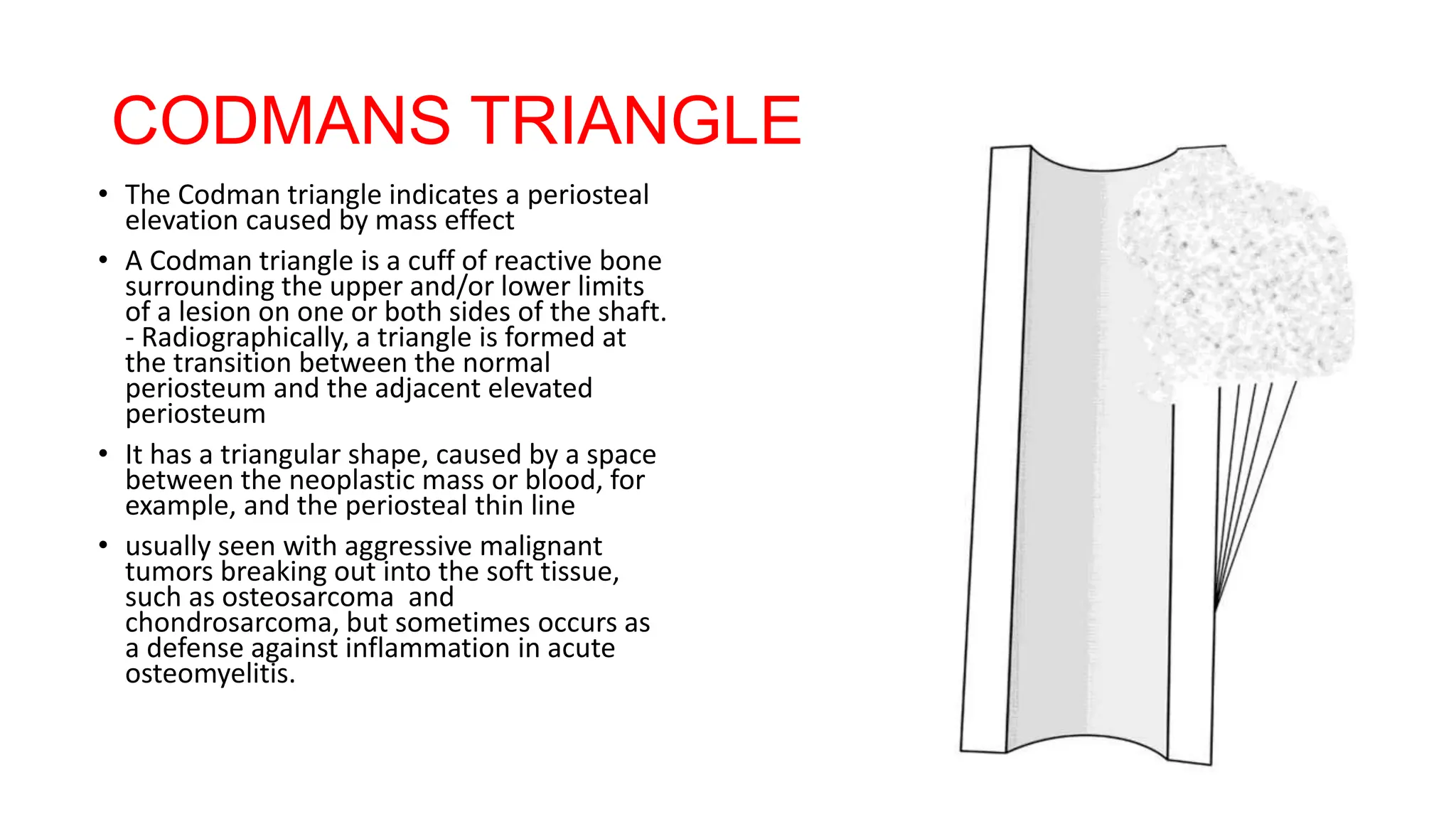 periosteal reaction radiology review.pptx