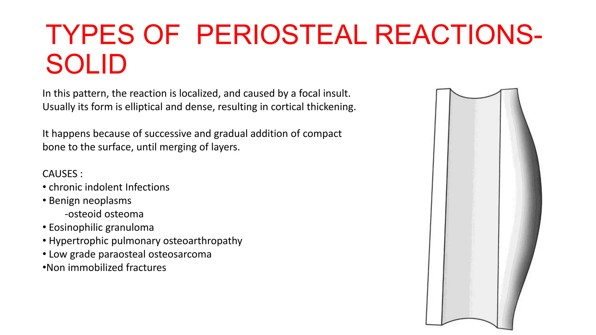 periosteal reaction radiology review.pptx