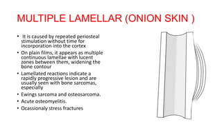 periosteal reaction radiology review.pptx