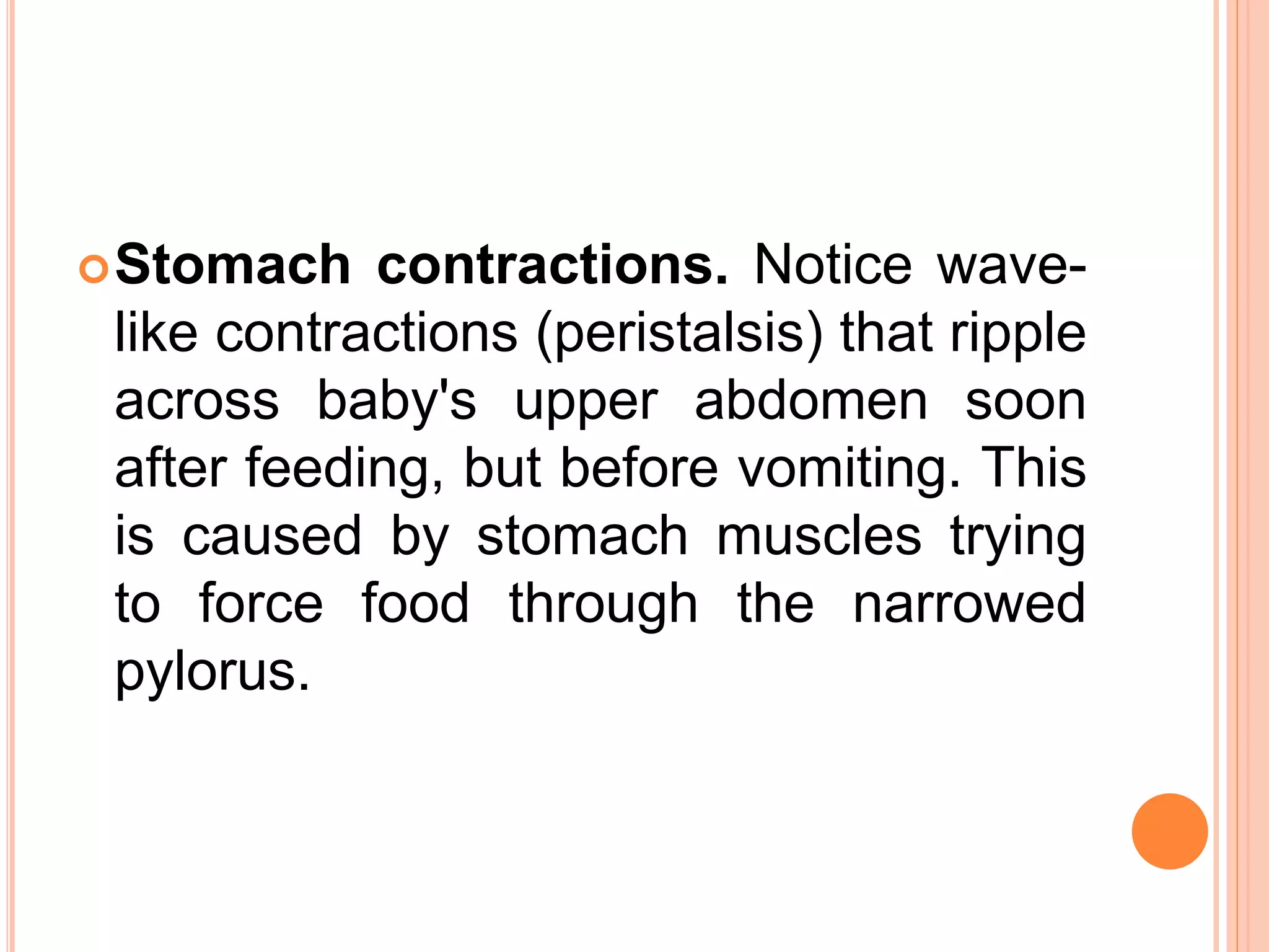 Pyloric stenosis | PPTX
