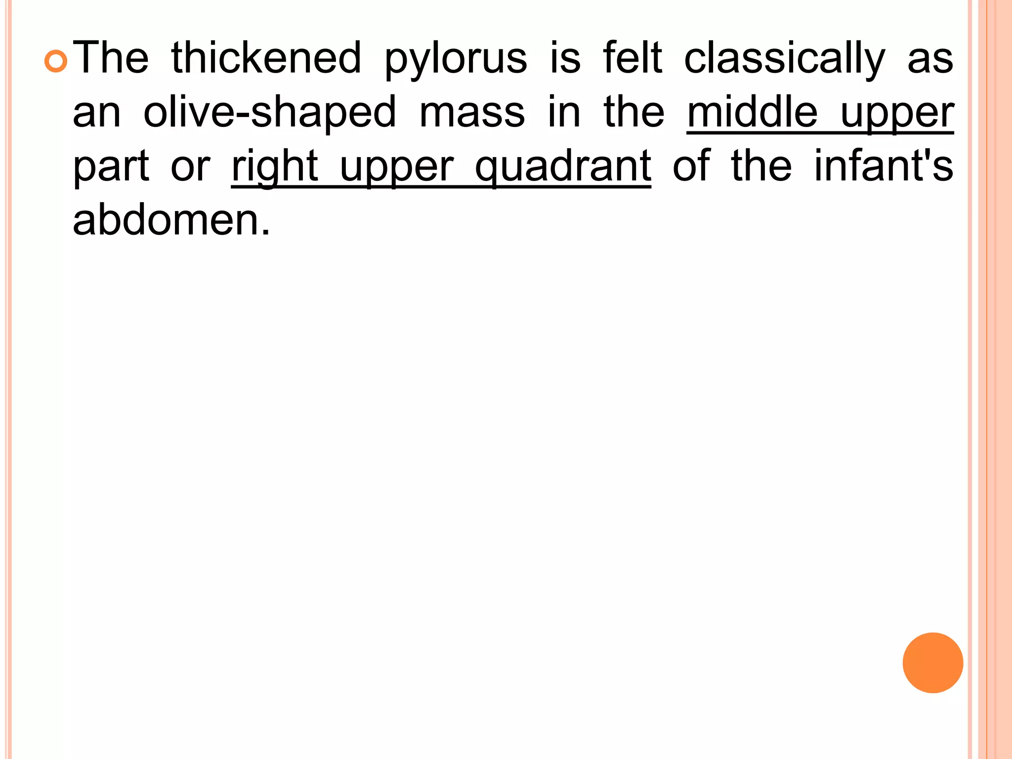Pyloric stenosis | PPTX