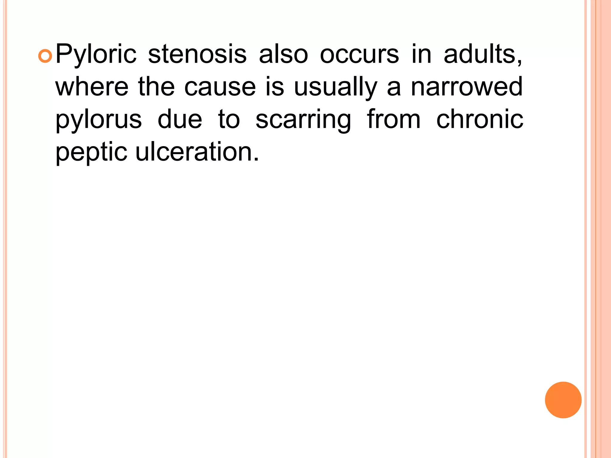 Pyloric stenosis | PPTX