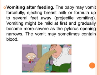 Projectile Vomiting Family Guy