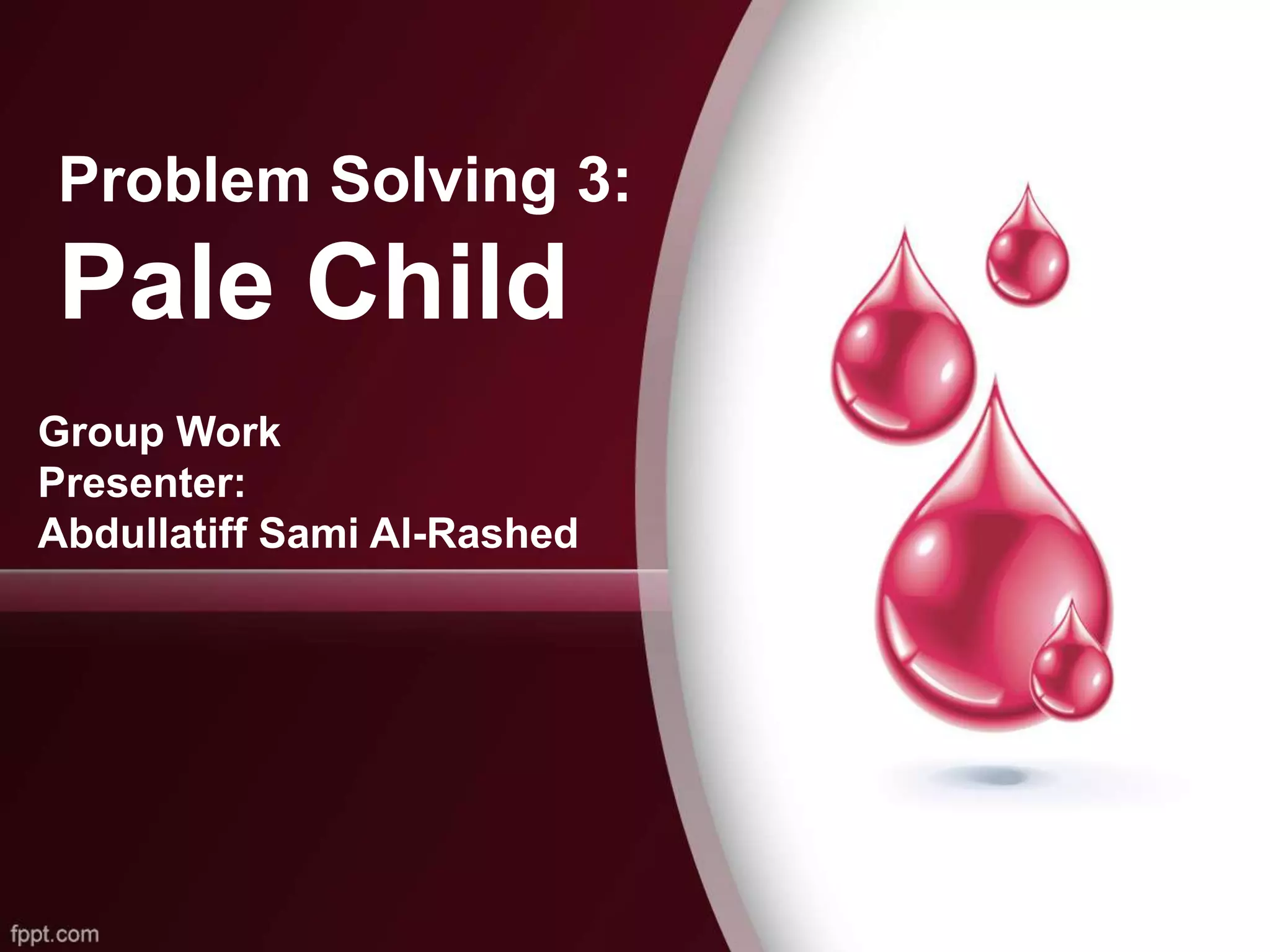 Approach to Iron Deficiency Anemia in Children | PPTX