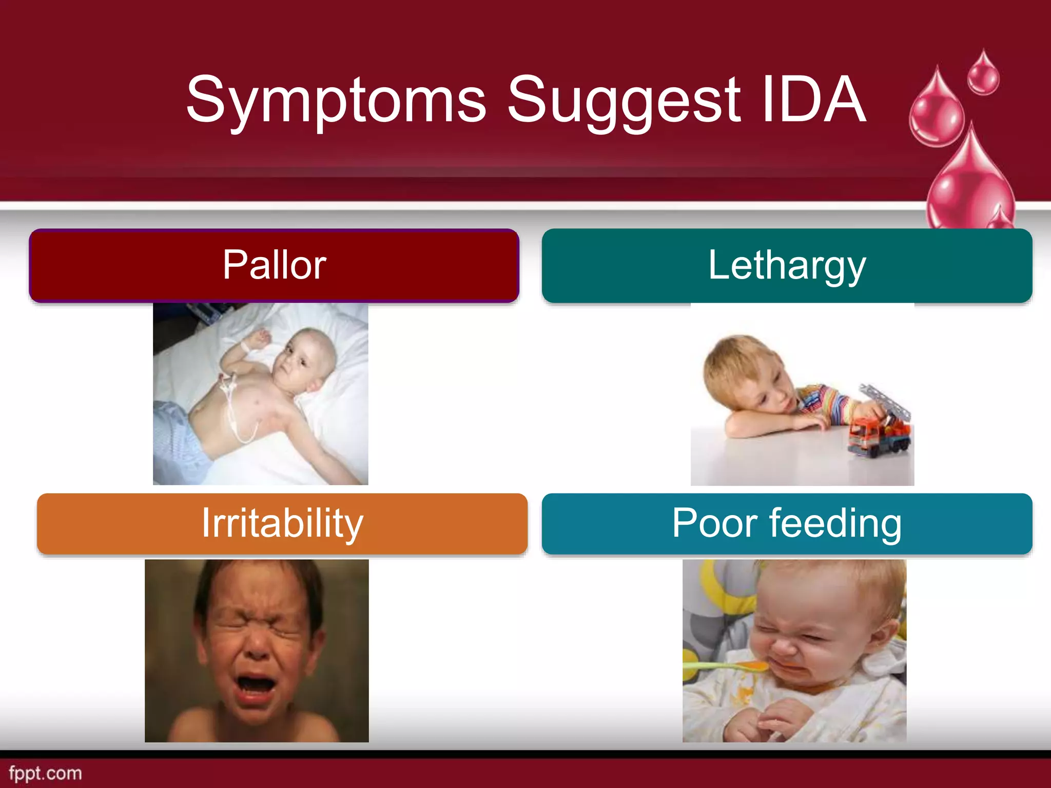 Approach to Iron Deficiency Anemia in Children | PPTX