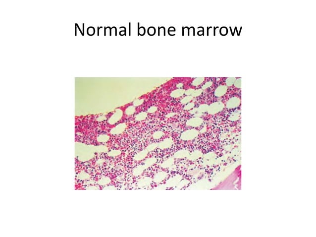 Peripheral Smear & Bone Marrow | PPT