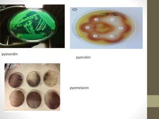 PSEDOMONAS.pptx for educational purposes | PPT