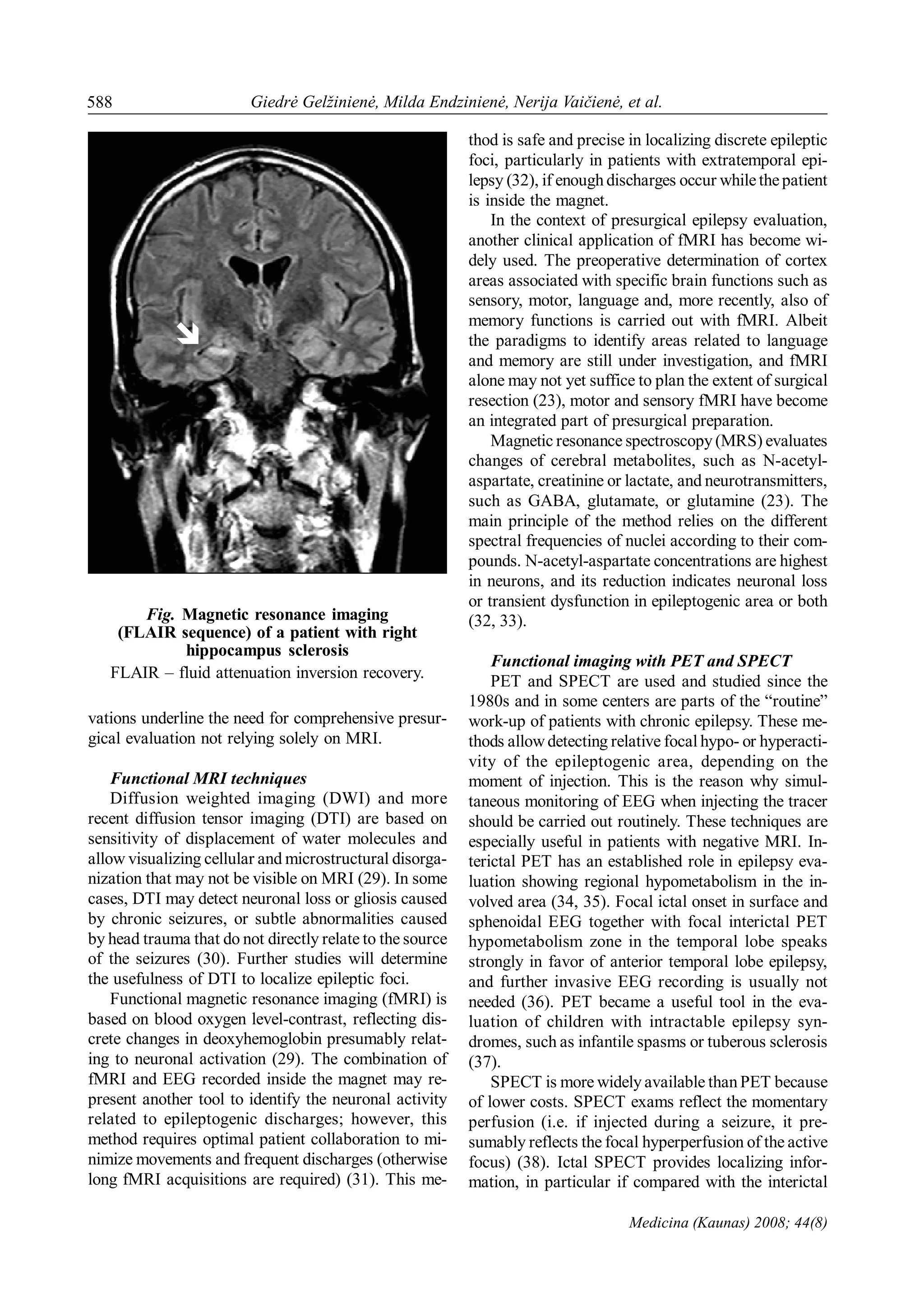 Presurgical Evaluation Of Epilepsy Pdf