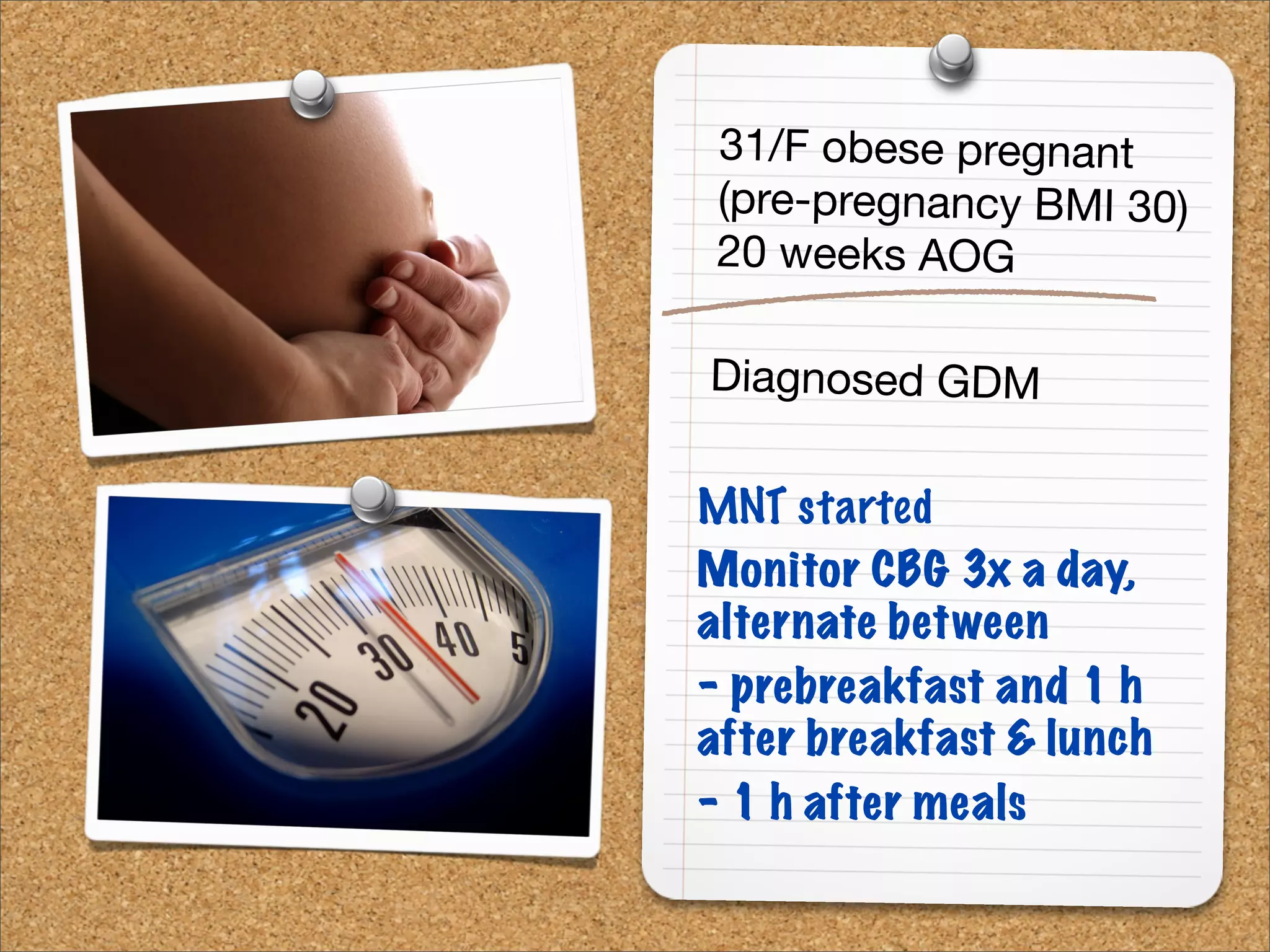 Clinical Practice Guideline: Gestational Diabetes | PDF