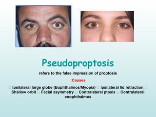 Pseudo-Ophthalmology ! | PPT