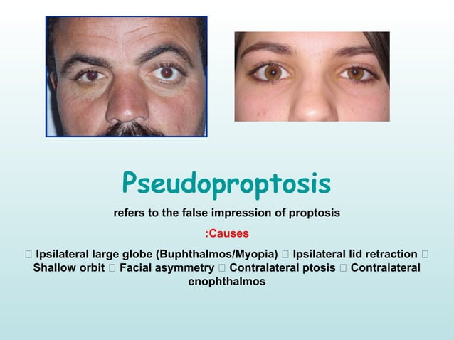 Pseudo-Ophthalmology ! | PPT | Eye and Vision Conditions | Diseases and ...