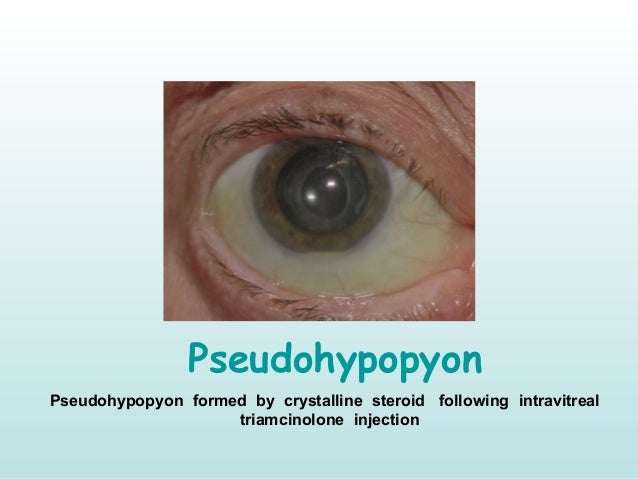 Pseudo-Ophthalmology