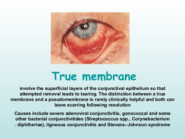 Pseudo-Ophthalmology