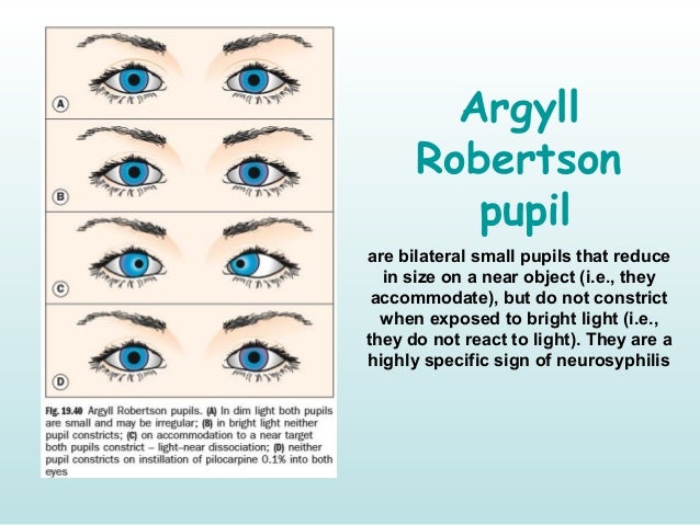 Pseudo-Ophthalmology