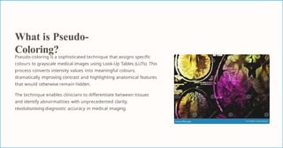 Pseudo-Code-Coloring-in-Medical-Image-Processing-Enhancing-Visual ...