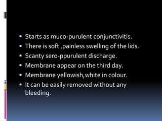 Pseudo membranous conjunctivitis | PPTX