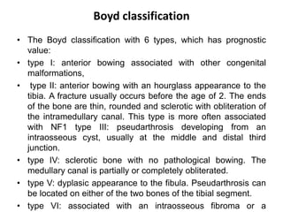 Pseudoarthrosis tibia | PPTX