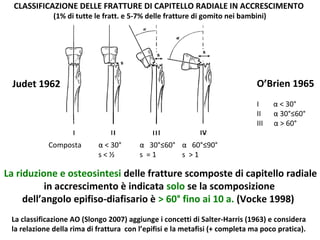 Pseudoartrosi capitello radiale nel bambino: caso clinico (seondo corso ...