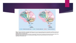 Pseudobulbar Affect | PPT