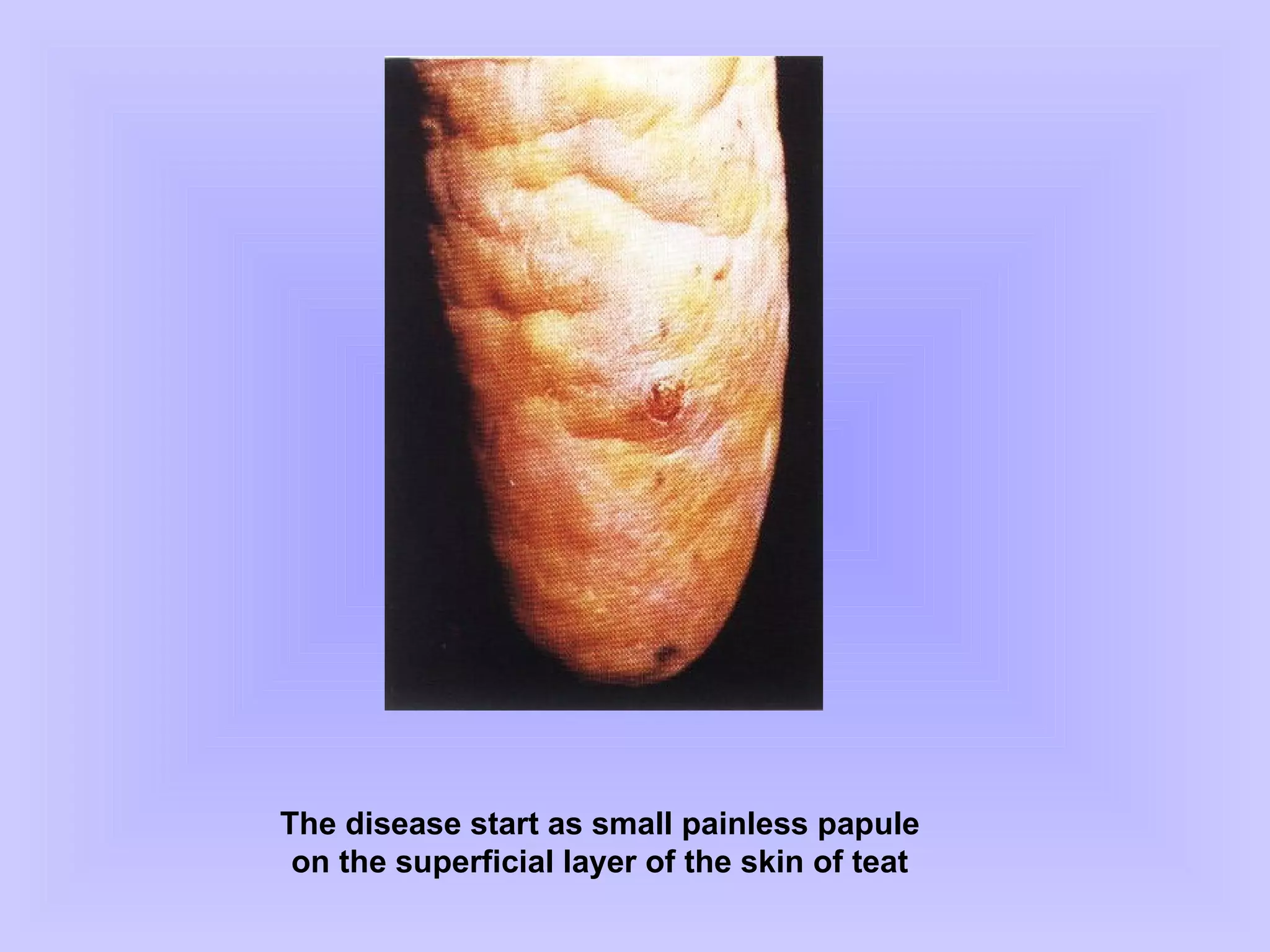 Pseudo cow pox | PPT