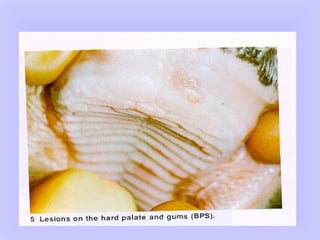 Pseudo cow pox | PPS