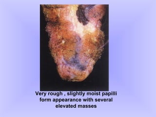 Pseudo cow pox | PPS