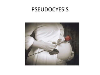 Pseudocyesis final | PPTX
