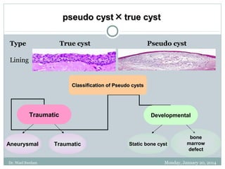 Pseudo cyst | PPS