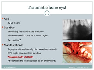 Pseudo cyst | PPS
