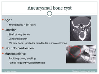 Aneurysmal Bone Cyst Jaw