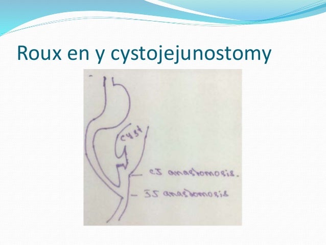 Pseudocyst of pancreas