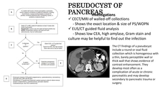 Pseudocyst of Pancreas- How to DIAGNOSE & TREAT- Epigastric Lumps ...