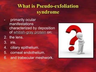 Pseudoexfoliation glaucoma | PPT
