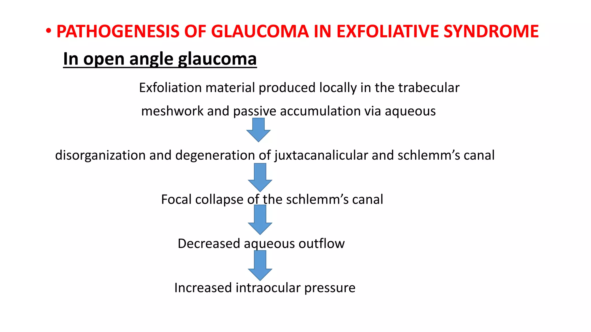 Pseudoexfoliative glaucoma seminar | PPTX