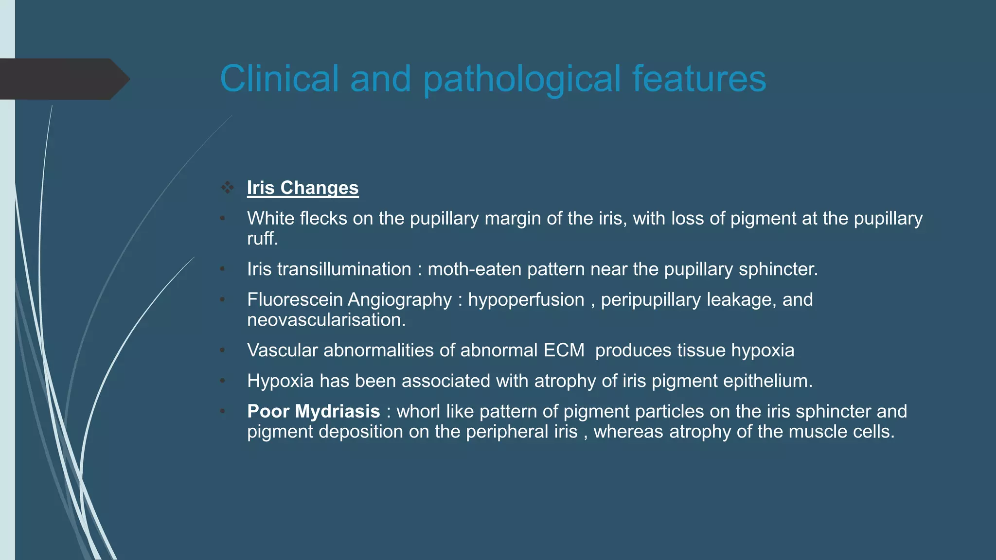 Pseudoexfoliative syndrome and pigment dispersion syndrome and glaucoma ...