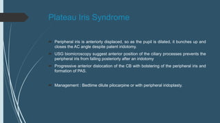 Pseudoexfoliative syndrome and pigment dispersion syndrome and glaucoma ...