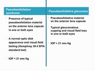 Pseudoexfoliative glaucoma and pseudo exfoliative syndrome | PPTX