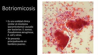 Pseudomicosis presentación enfoque clinico | PPTX