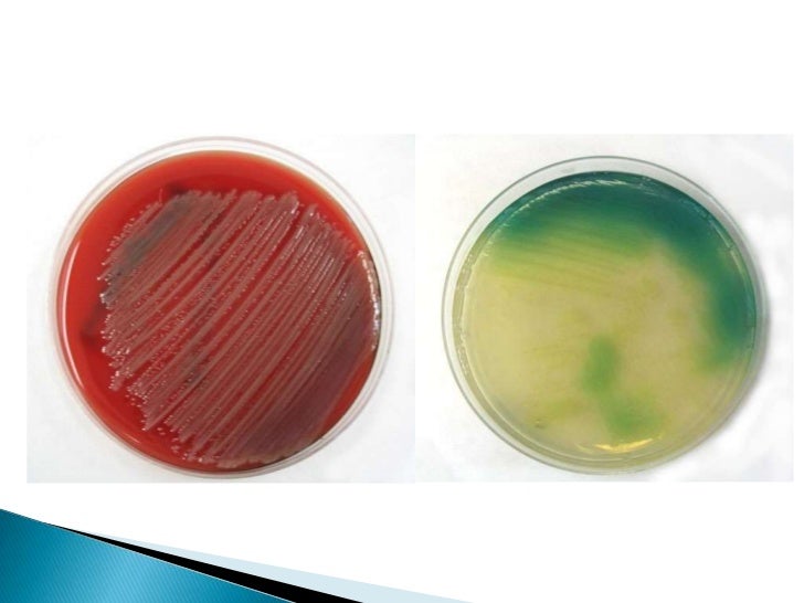 Pseudomonas Aeruginosa On Macconkey Agar
